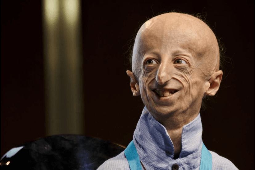 ¿Sabías que el personaje de Benjamin Button existió en la vida real ...
